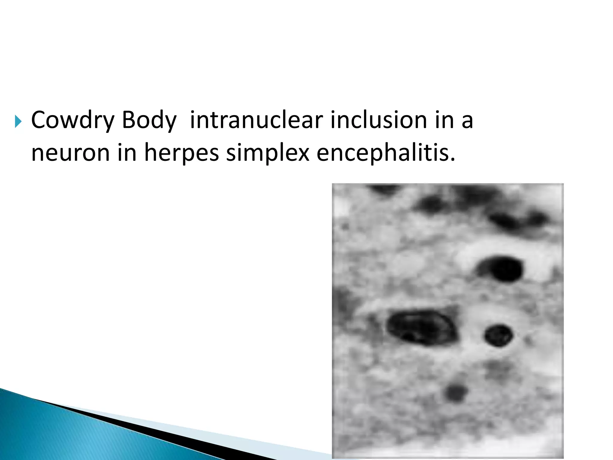 Infectious CNS diseases | PPTX