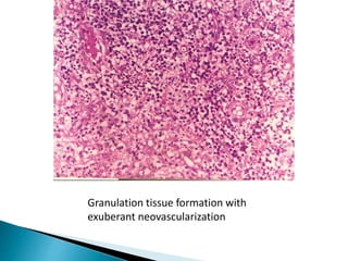 Infectious CNS diseases | PPTX