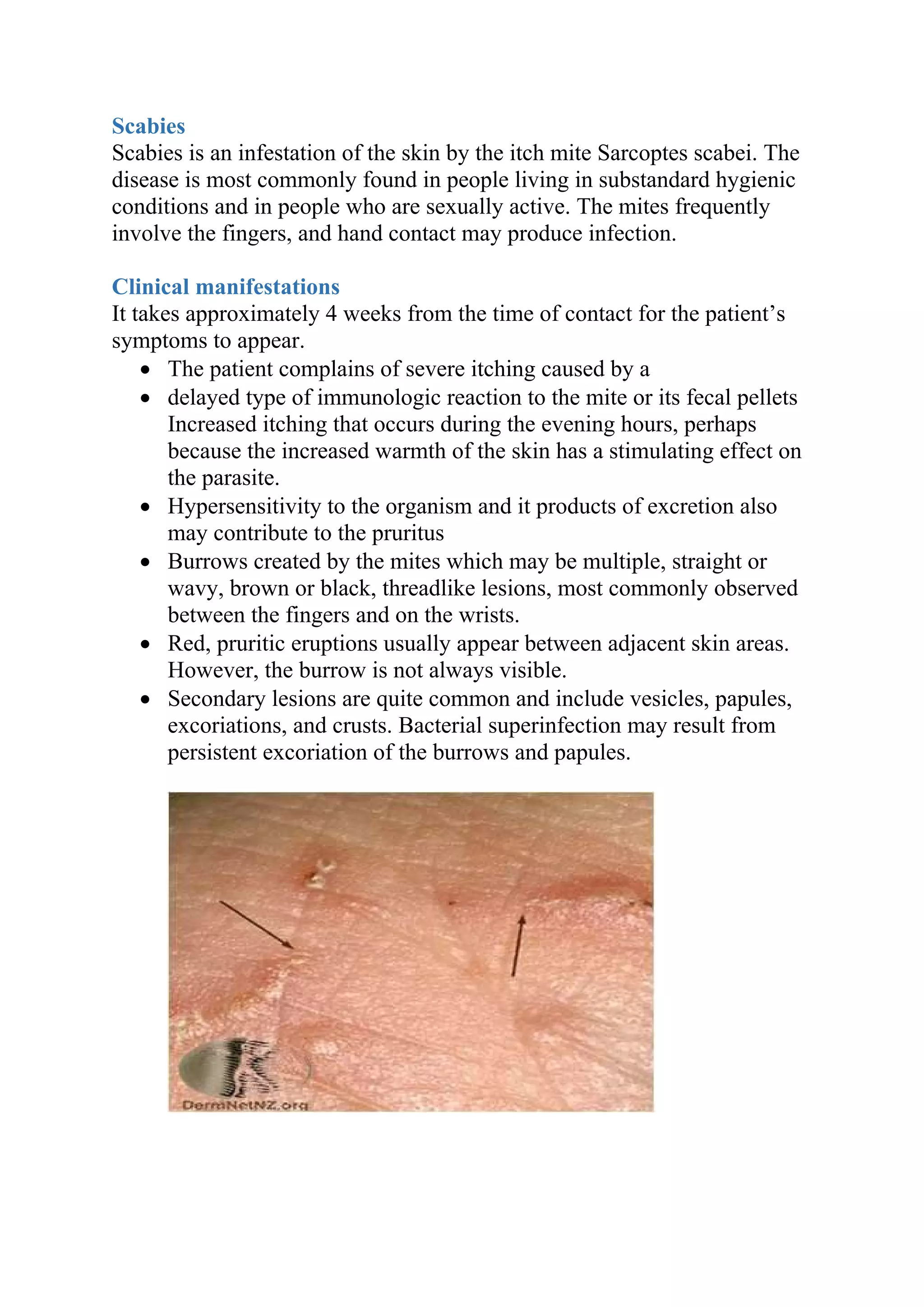 Infectious dermatoses | PDF