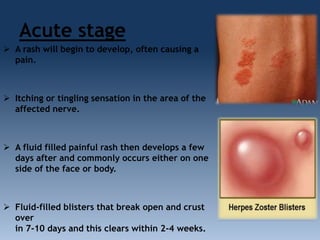 Infectious dermatoses | PDF