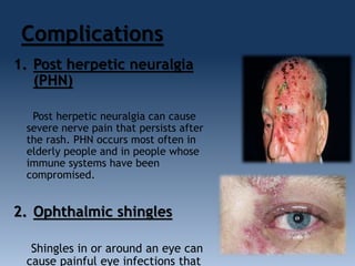 Infectious dermatoses | PDF