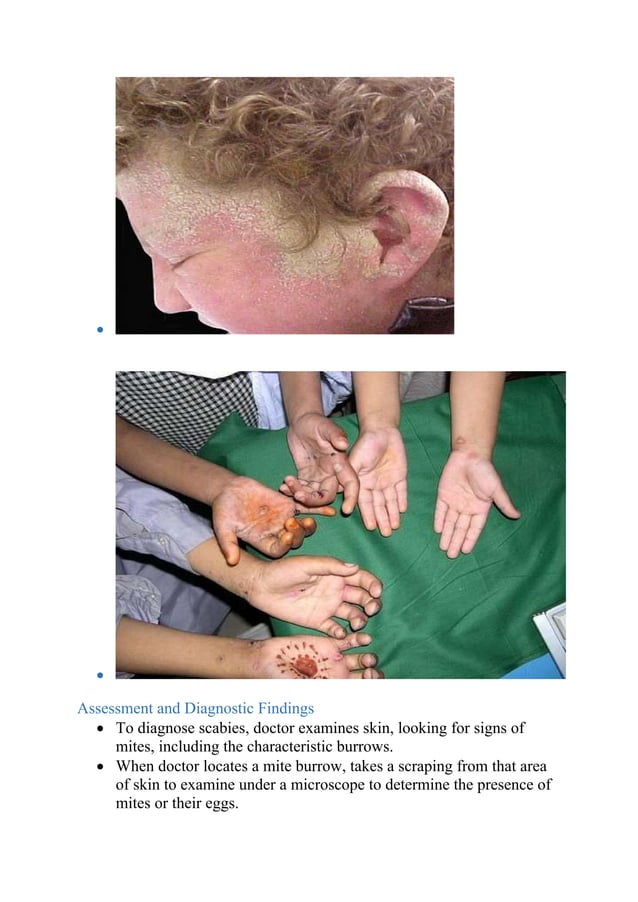 Infectious dermatoses | PDF | Infectious Diseases | Diseases and Conditions