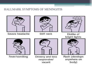 MENINGITIS, TB, TYPHOID, LEPROSY | PPTX