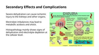 Infectious Disease Cholera Histopathology, Pathanatomy.pptx
