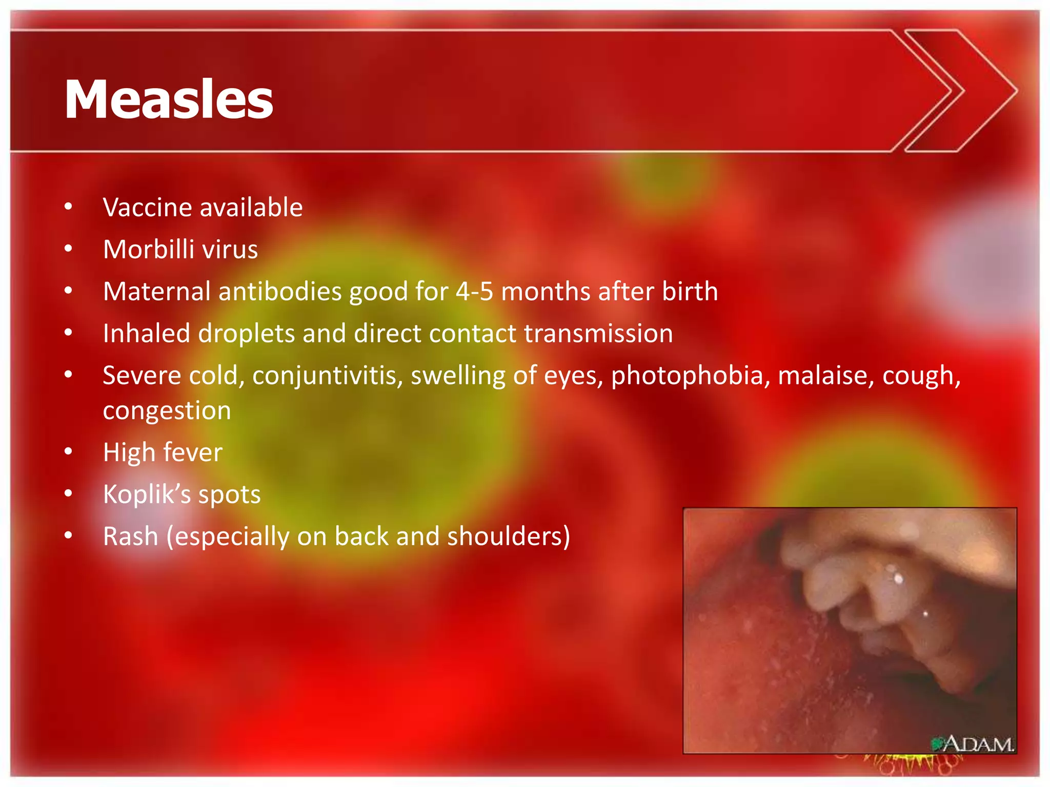 Infectious diseases | PPTX