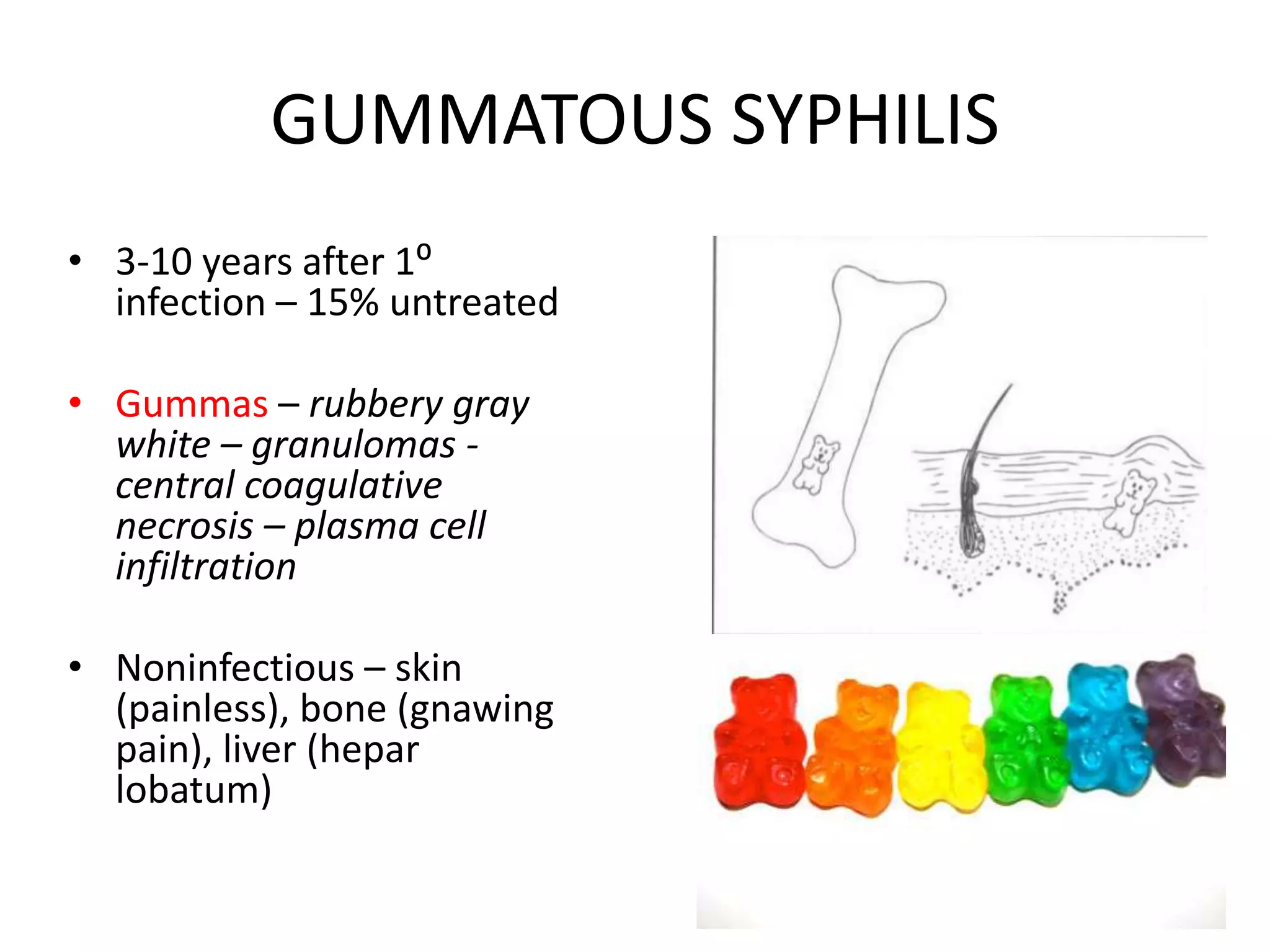 Infectious diseases - Typhoid, Syphilis | PPTX