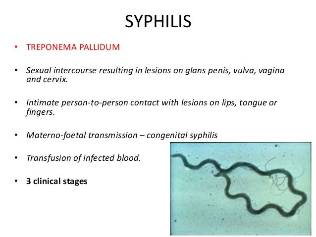 Infectious Diseases Typhoid Syphilis
