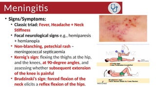Infectious Diseases in medical field.pptx