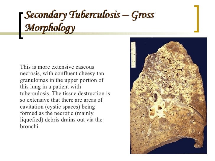 Infectious Diseases 12