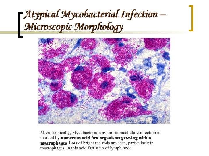 Infectious Diseases 12