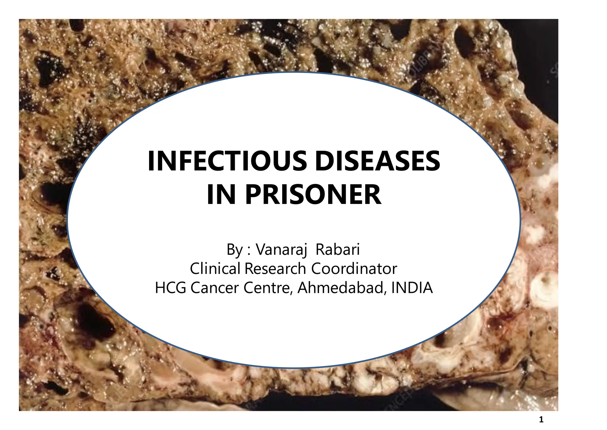 Types of Infectious Diseases In Prisoners. | PDF