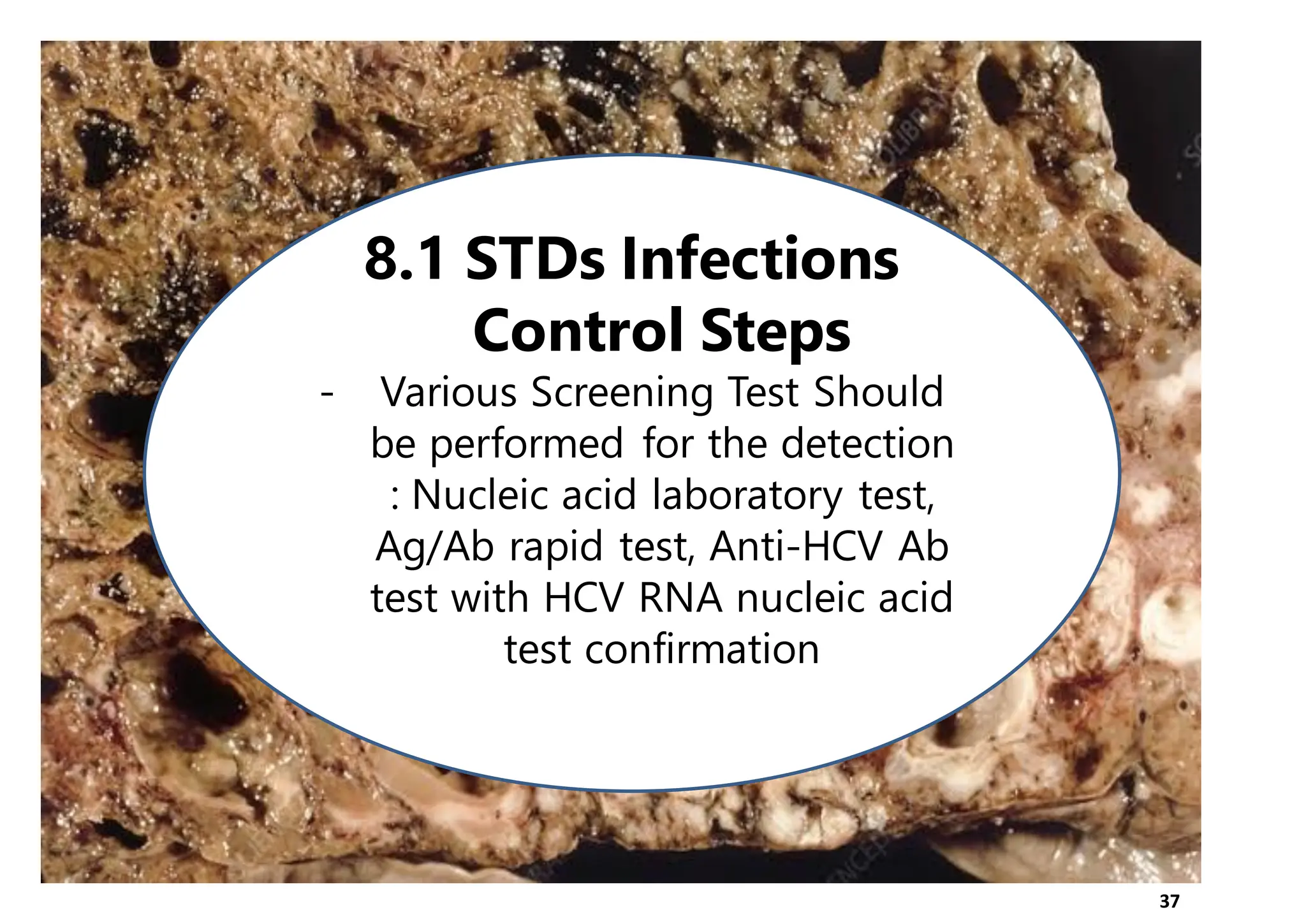 Types of Infectious Diseases In Prisoners. | PDF