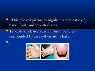 Generalized Erythema
