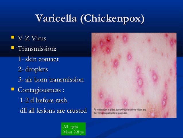 Infectious disease skin rash