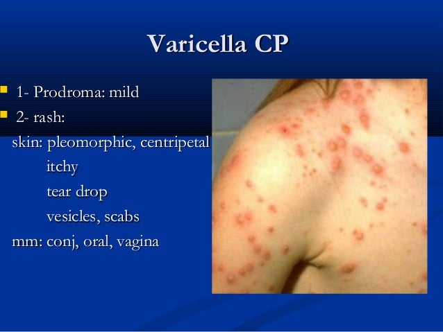 Infectious disease skin rash