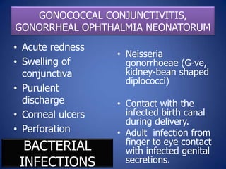 Infectious diseases of the ears,eyes,mouth | PPTX | Ear, Nose and Throat Conditions | Diseases ...
