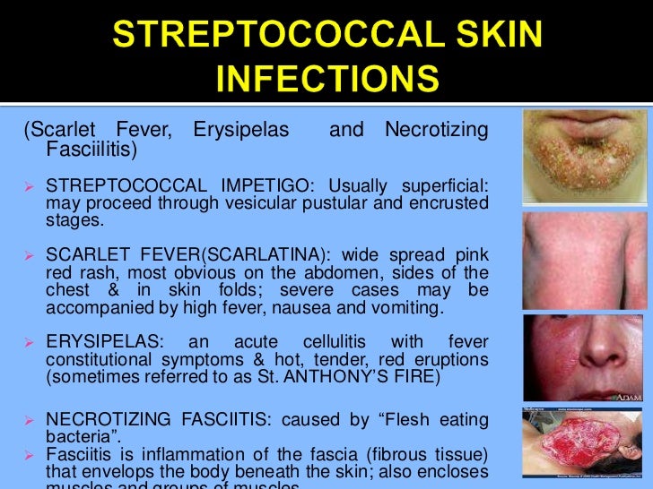 Infectious diseases of the skin and wound
