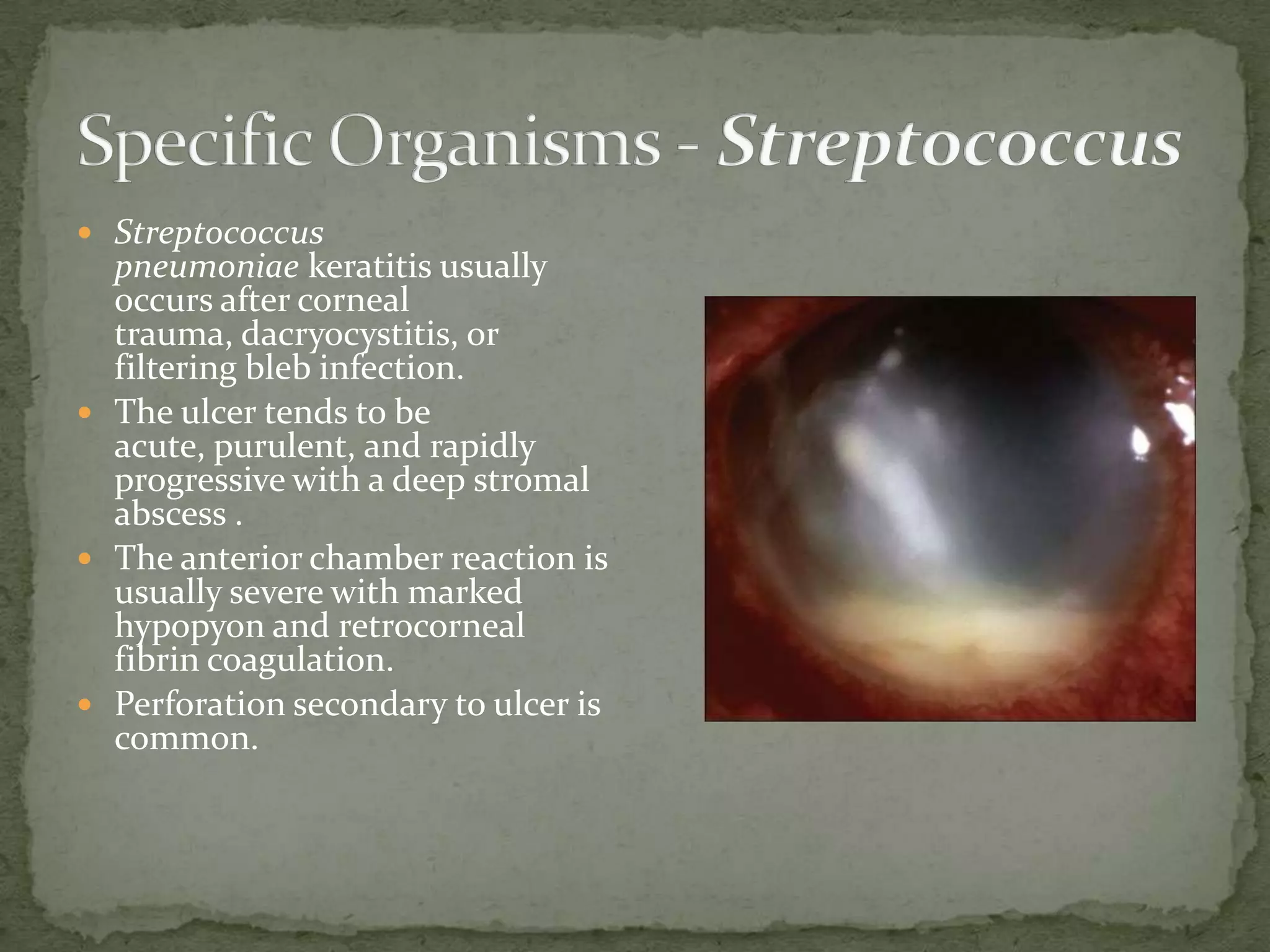 Infectious Keratitis | PPTX