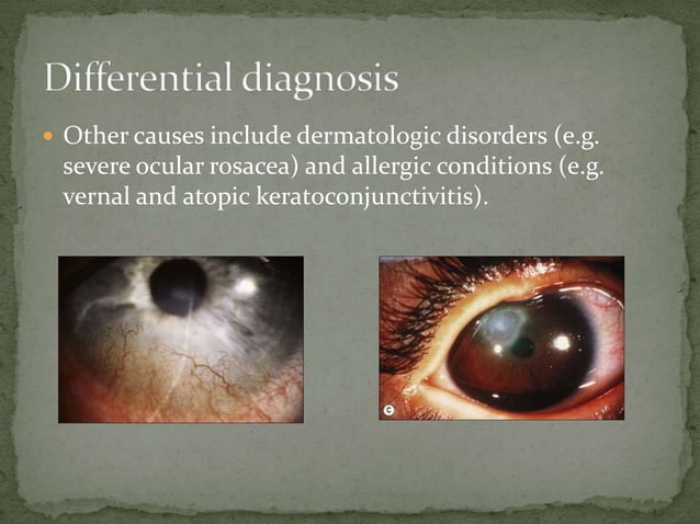 Infectious Keratitis | PPTX | Eye and Vision Conditions | Diseases and Conditions