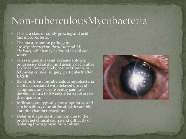 Infectious Keratitis 