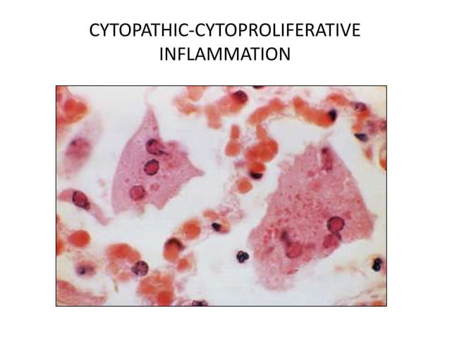 Introduction to Infectious Diseases and Bacterial Infections | PPTX
