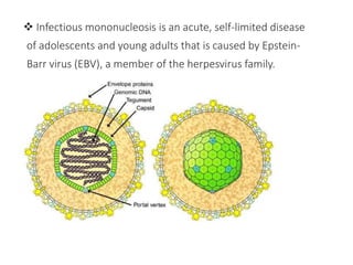 Infectious Mononucleosis - Pathology | PPTX