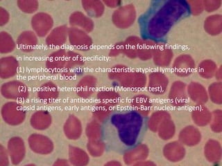 Infectious Mononucleosis Blood Smear