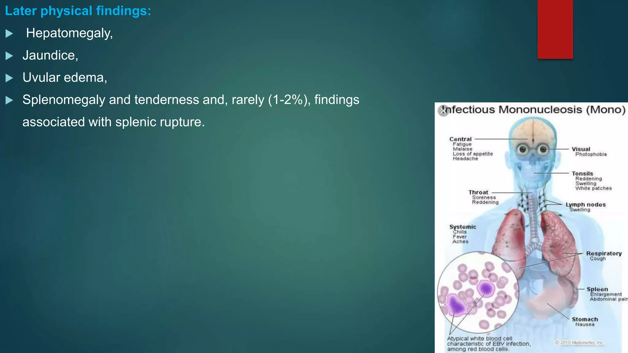 Infectious mononucleosis Made Extremely Simple!!! | PPTX