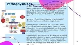 infectious mononucleosis detailed presentation | PPT