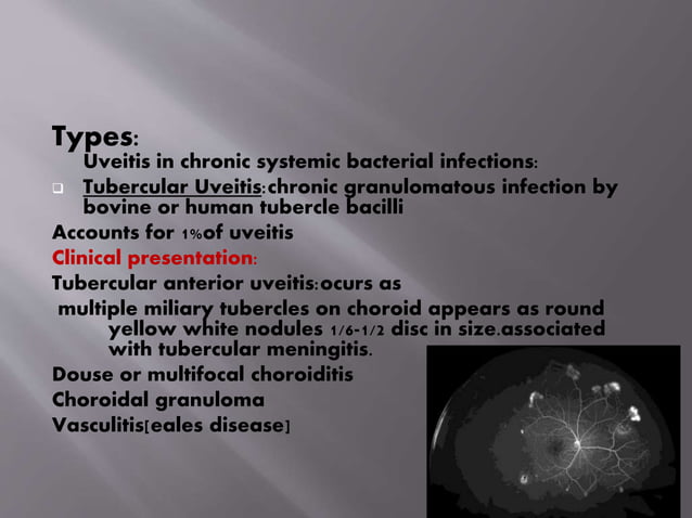 Infectious uveitis | PPTX | Eye and Vision Conditions | Diseases and ...