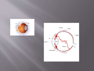 Infectious uveitis | PPTX | Eye and Vision Conditions | Diseases and ...