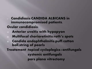 Infectious uveitis | PPTX