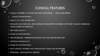 Infective Conjunctivitis acute follicular conjunctivitis associated ...