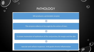 Infective Conjunctivitis acute follicular conjunctivitis associated ...