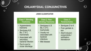Infective Conjunctivitis acute follicular conjunctivitis associated ...