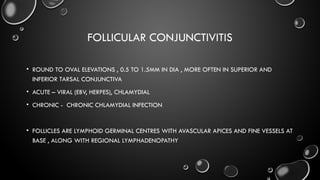 Infective Conjunctivitis acute follicular conjunctivitis associated ...