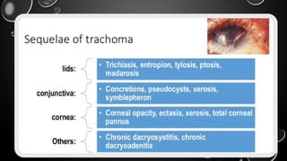 Infective Conjunctivitis acute follicular conjunctivitis associated ...