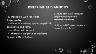 Infective Conjunctivitis acute follicular conjunctivitis associated ...