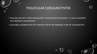Infective Conjunctivitis acute follicular conjunctivitis associated ...