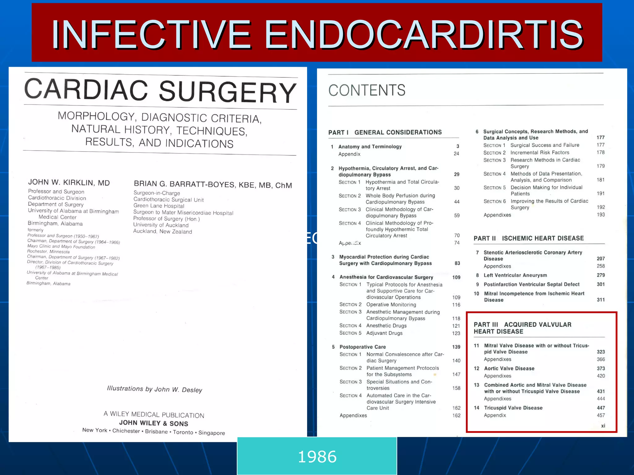 Infective endo. for 18th eschs marriot | PPT | Heart and Cardiovascular ...