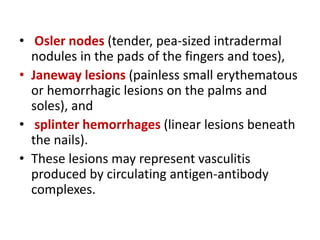 Infective endocarditis | PPTX