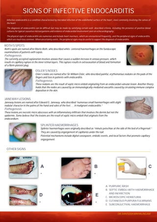 Infective Endocarditis Signs