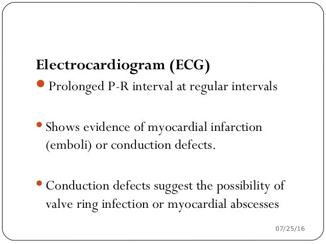 Endocarditis Ecg