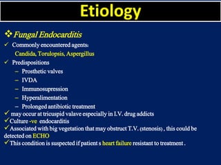 Infective endocarditis | PPTX