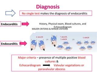 Infective endocarditis | PPT | Heart and Cardiovascular Diseases ...