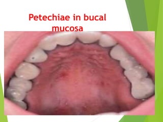 infectiveendocarditis-180301061044 (1).pdf