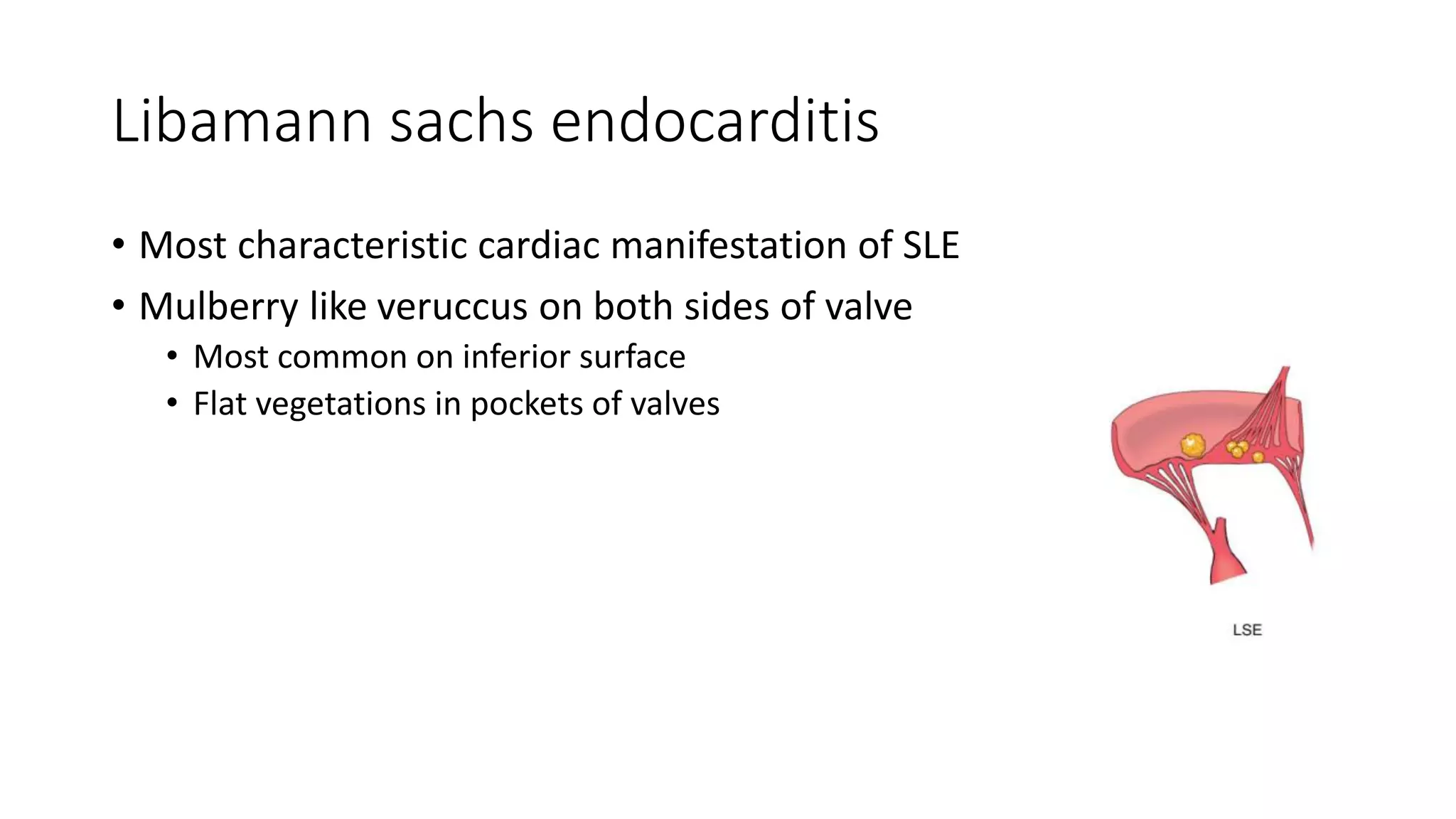 Infective endocarditis revision notes | PDF