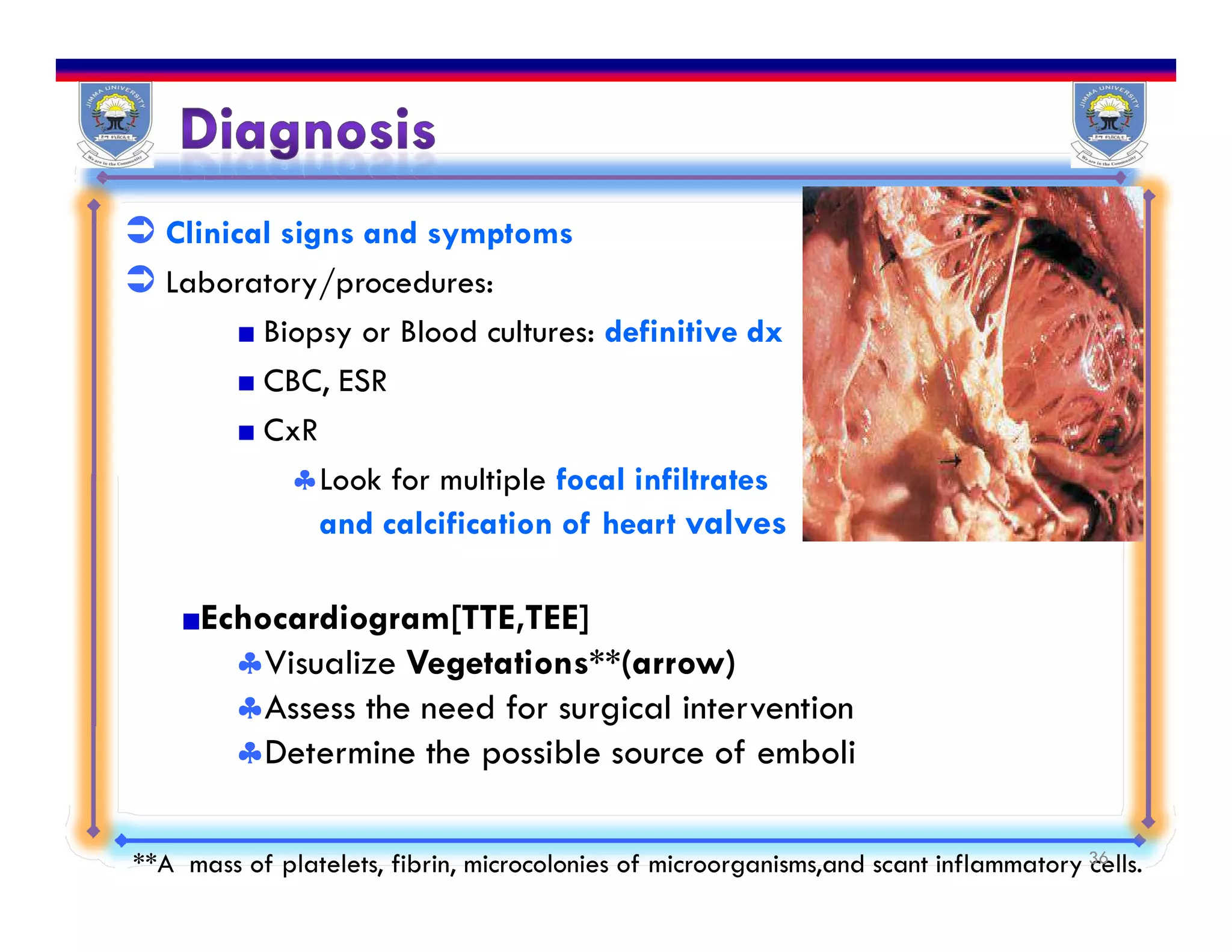 Pharmacotherapy of Infective endocarditis | PDF