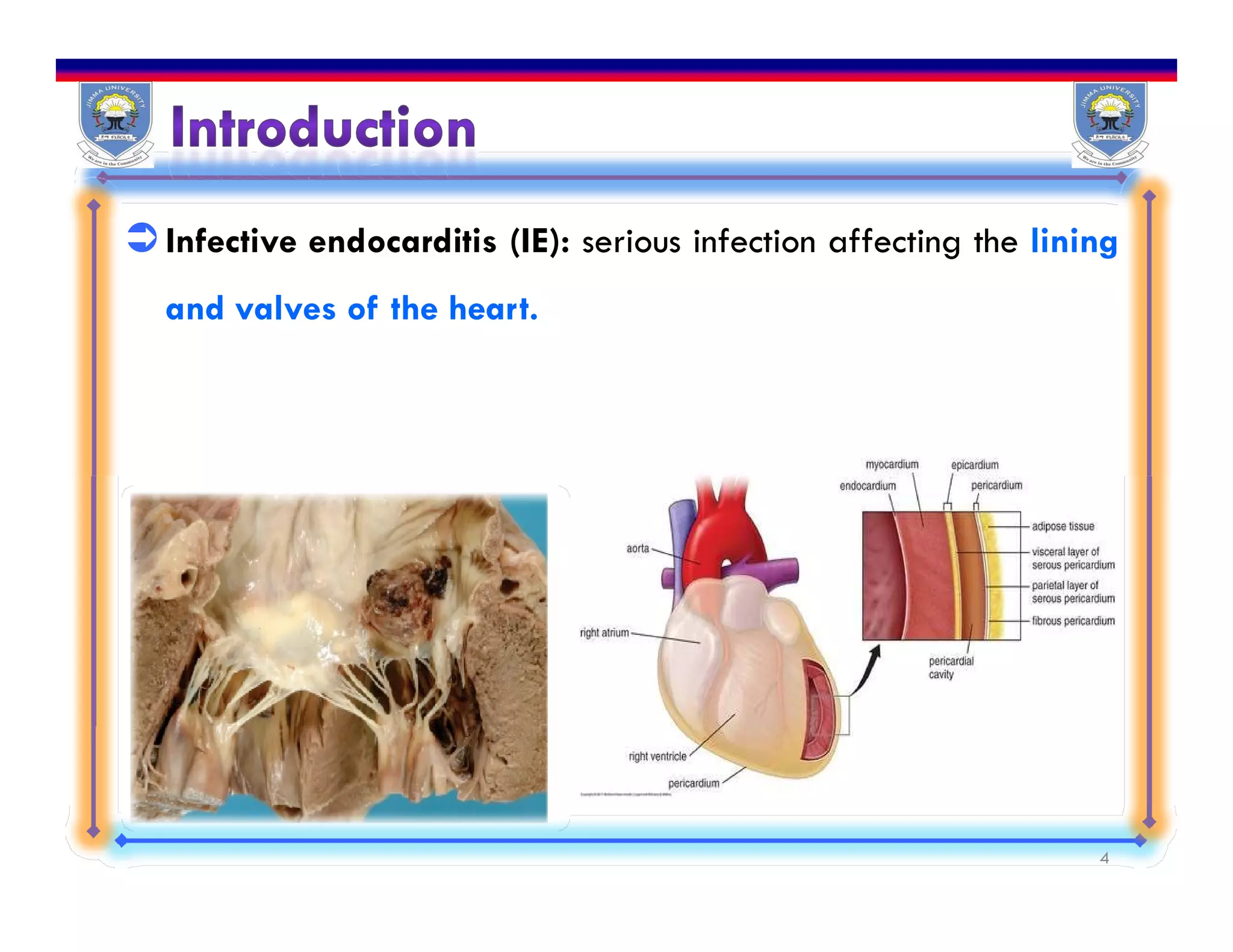 Pharmacotherapy of Infective endocarditis | PDF