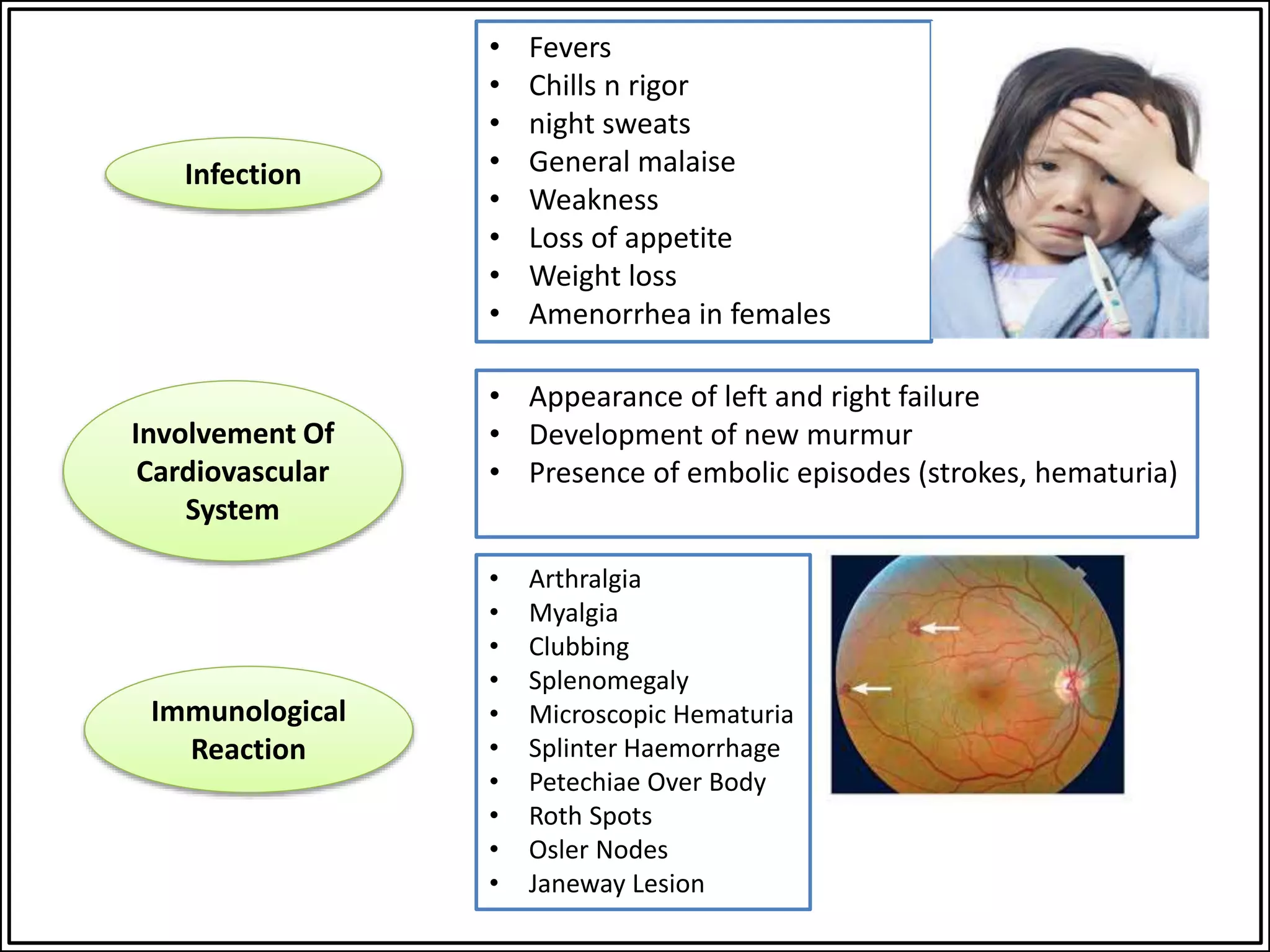 Infective Endocarditis Paediatrics | PPTX